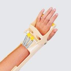 Dyna Cockup splint - Dynamic Techno Medicals