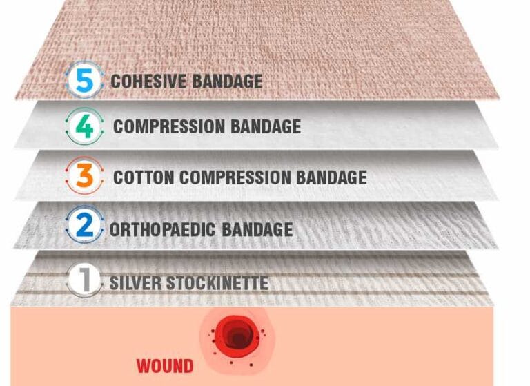 4-LB Multi Layer Compression Bandaging System - Dynamic Techno Medicals