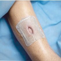 Sterizone ST Antimicrobial Silver Wound Dressing - Pack of 4 - Dynamic ...