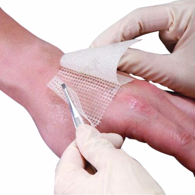 Sterizone ST Antimicrobial Silver Wound Dressing - Pack of 4 - Dynamic ...